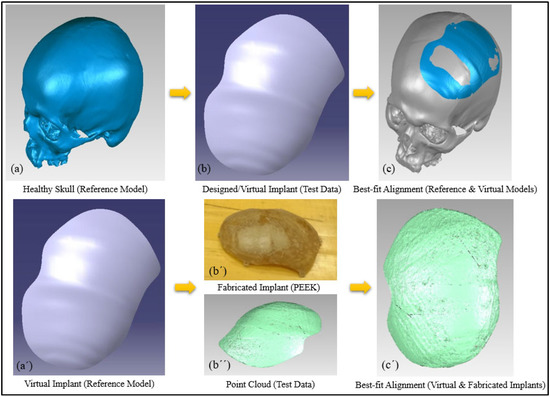 Adaptive Mechanism for Designing a Personalized Cranial Implant and Its ...