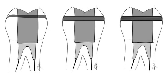 Polymers | Free Full-Text | Mechanical Performance of Direct ...
