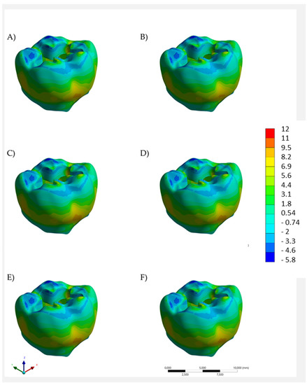 Polymers | Free Full-Text | Mechanical Behavior of Alkasite Posterior ...