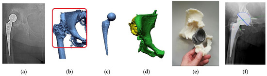 Manufacturing Polymer Model of Anatomical Structures with Increased ...