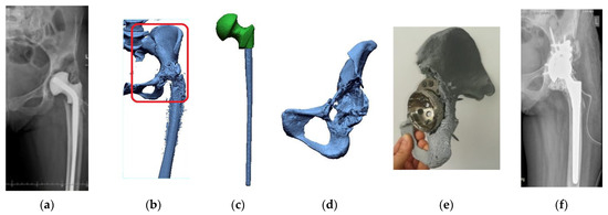 Manufacturing Polymer Model of Anatomical Structures with Increased ...