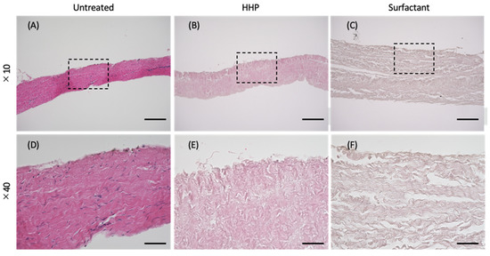 In Vitro Tissue Reconstruction Using Decellularized Pericardium ...