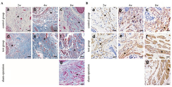 Construction of Tissue-Engineered Bladder Scaffolds with Composite ...