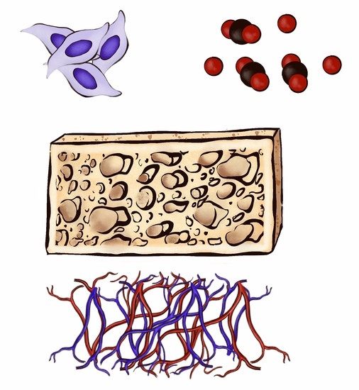 Polymers | Free Full-Text | In Vivo Bone Tissue Engineering Strategies ...