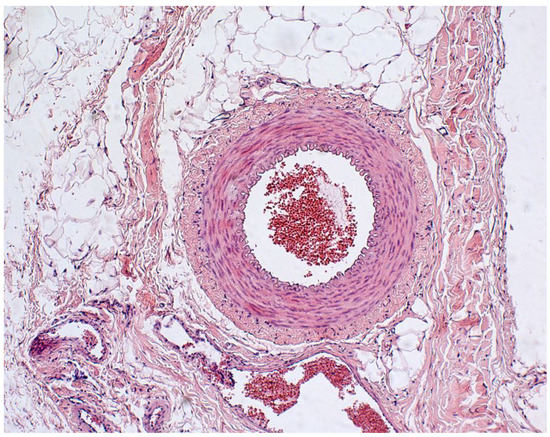 Synthesis, Chemical and Biomedical Aspects of the Use of Sulfated Chitosan