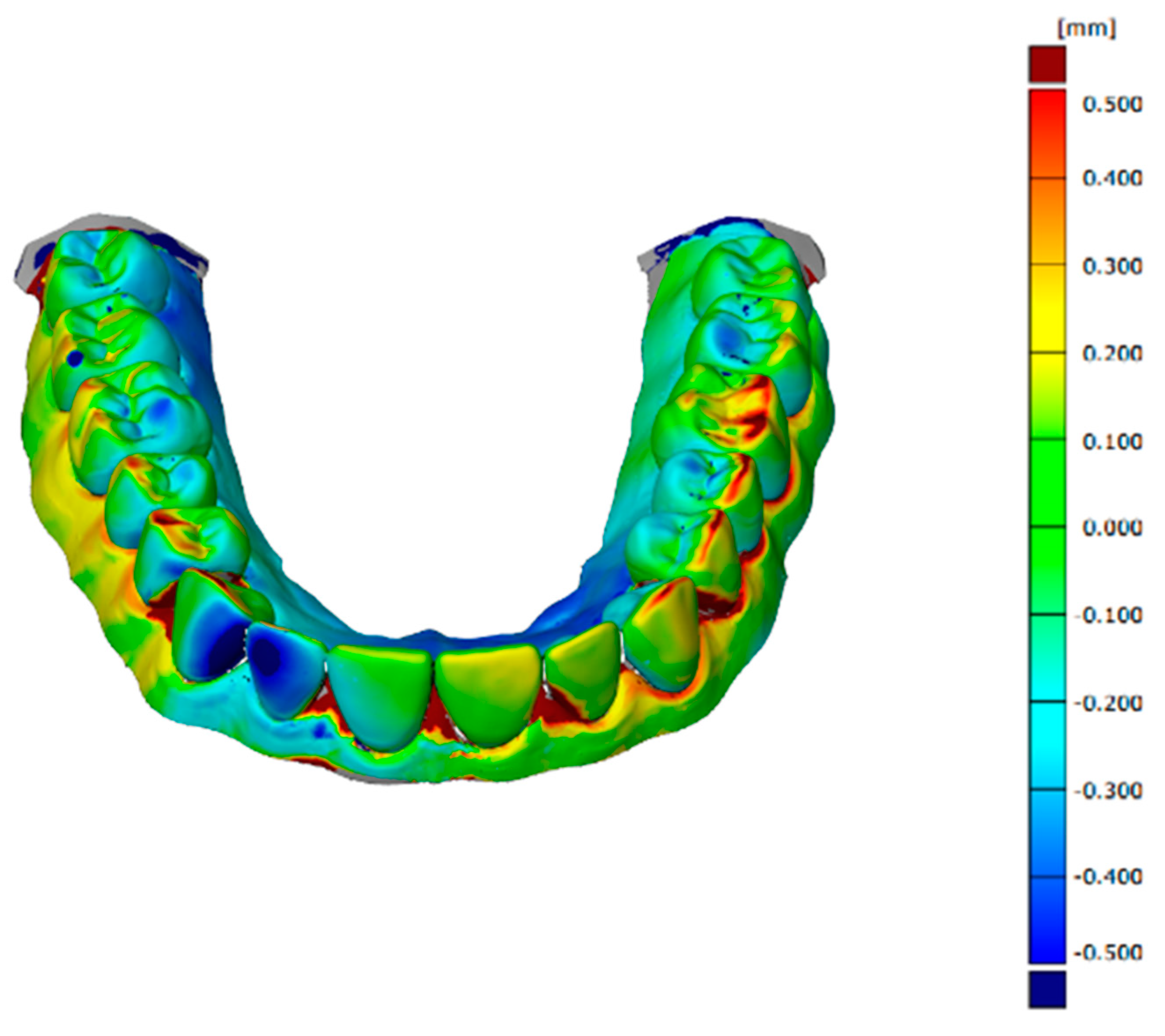 Extra-Oral Three-Dimensional (3D) Scanning Evaluation of Three ...