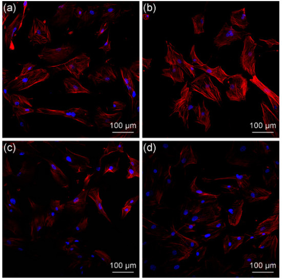 Polymers | Free Full-Text | Mechanical Properties and In Vitro ...