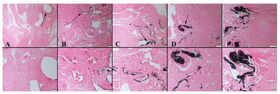 Bone Healing in Rat Segmental Femur Defects with Graphene-PCL-Coated ...