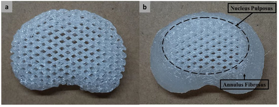 Anatomically and Biomechanically Relevant Monolithic Total Disc ...