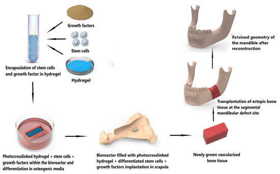 Hydrogel: A Potential Material for Bone Tissue Engineering Repairing ...