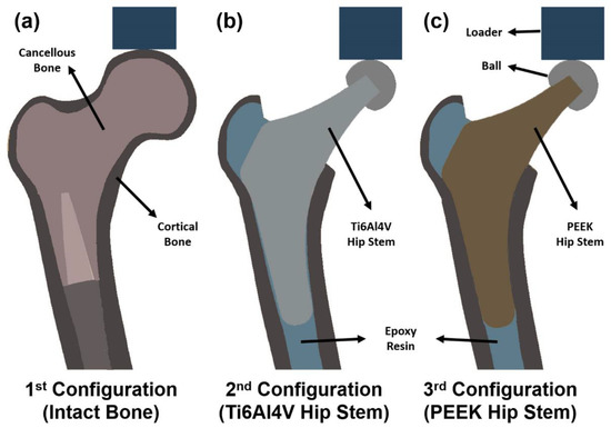 Stress Shielding and Bone Resorption of Press-Fit Polyether–Ether ...