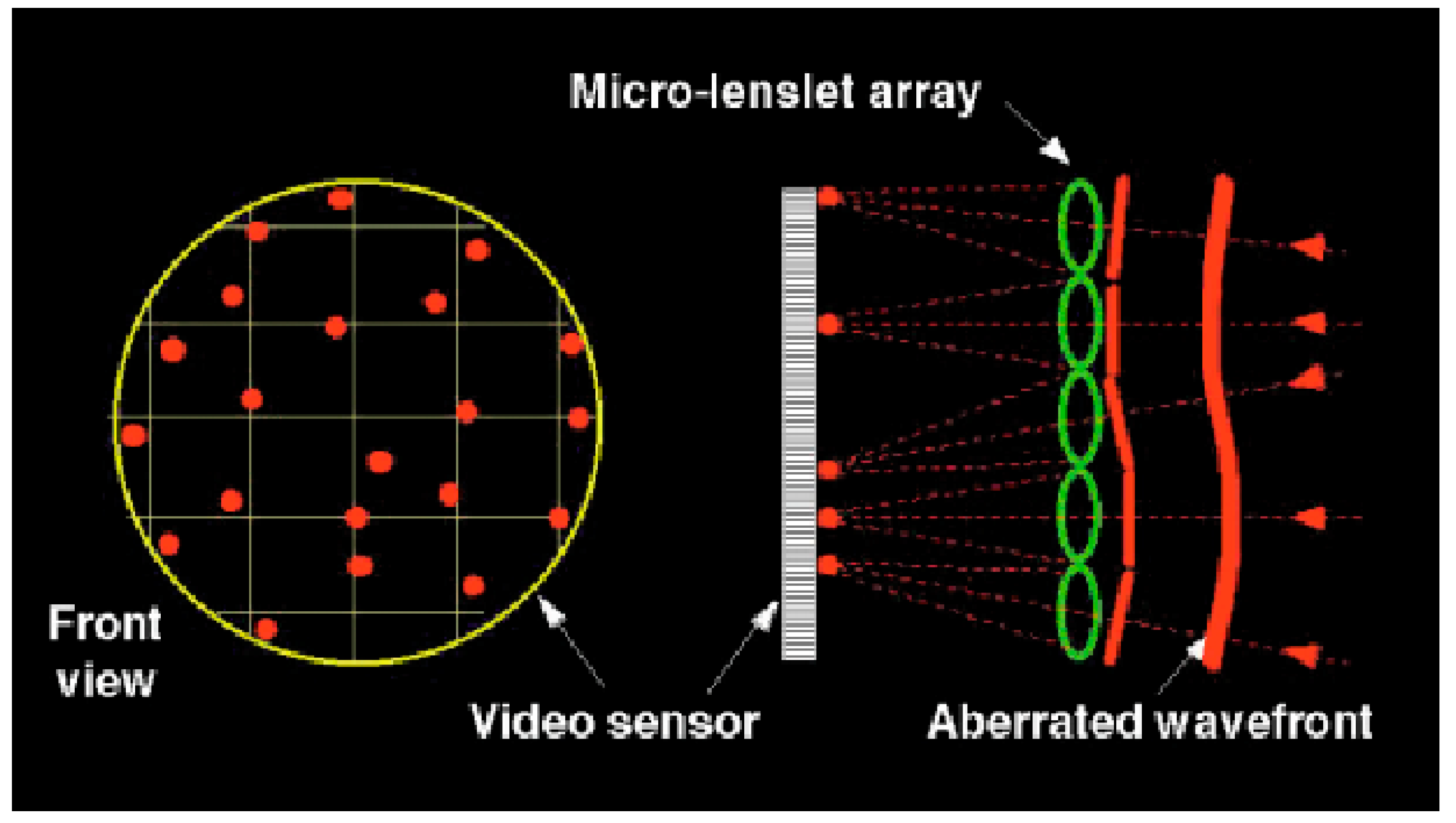 Polymers | Free Full-Text | Advanced Optical Wavefront Technologies to Improve Patient Quality ...
