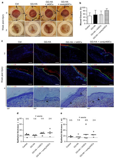 Biopolymer-Based Wound Dressings with Biochemical Cues for Cell ...