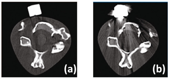Polymers | Free Full-Text | Poly (Ether-Ether-Ketone) for Biomedical ...