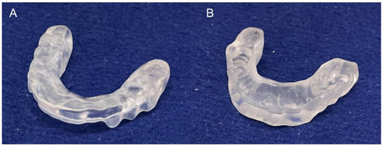 Effect of Surface Polishing on Physical Properties of an Occlusal ...