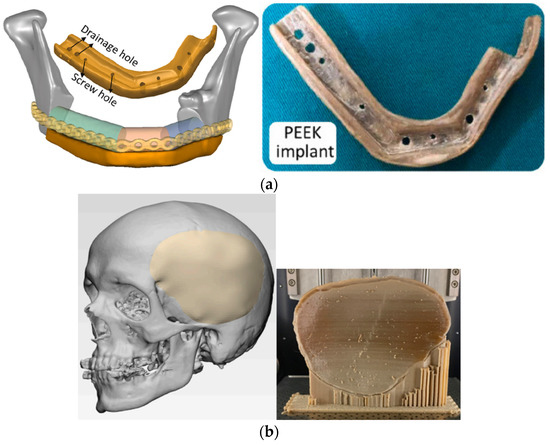 Influence of Process Parameters on the Characteristics of Additively ...