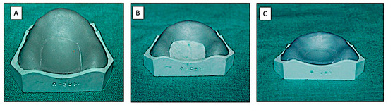 Dimensional Stability of Light-Activated Urethane Dimethacrylate ...