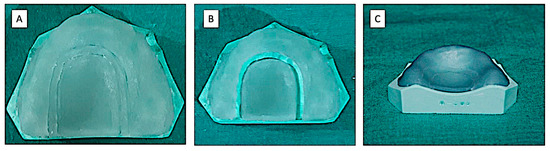 Dimensional Stability of Light-Activated Urethane Dimethacrylate ...