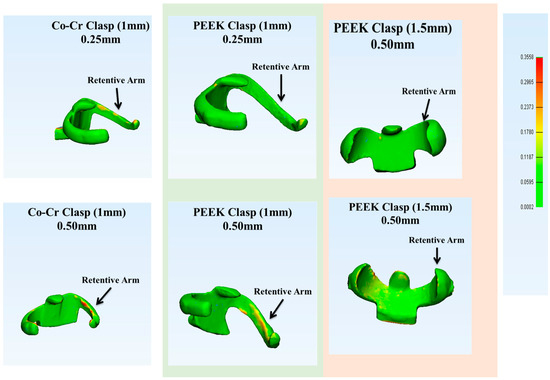 Retentive Forces and Deformation of Fitting Surface in RPD Clasp Made ...