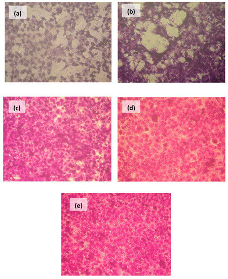 Design, Synthesis, and Characterization of Novel Bis-Uracil Chitosan Hydrogels Modified with ...