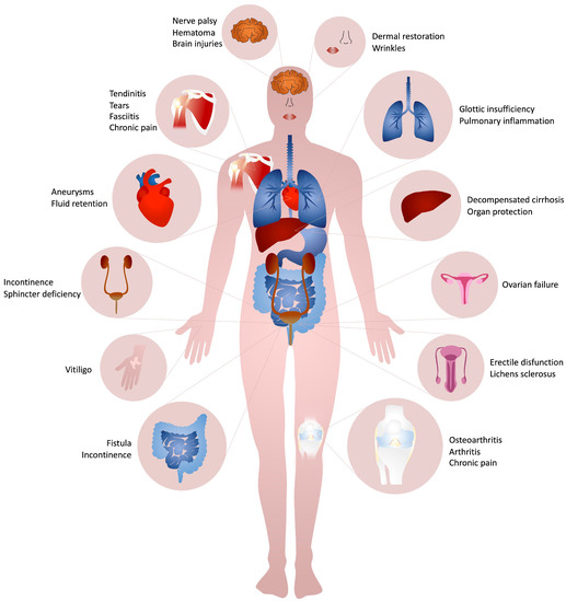 Polymers | Free Full-Text | An Update on the Clinical Efficacy and ...