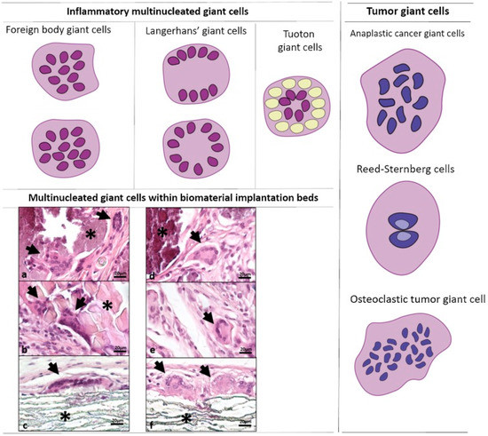 Mechanisms of Foreign Body Giant Cell Formation in Response to ...