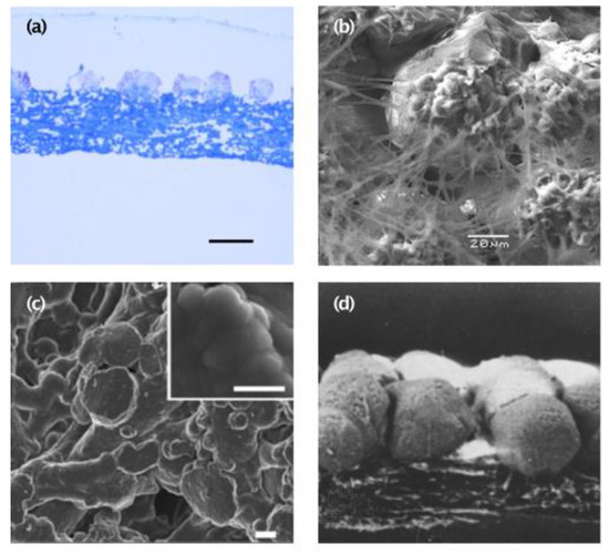 Eggshell Membrane as a Biomaterial for Bone Regeneration