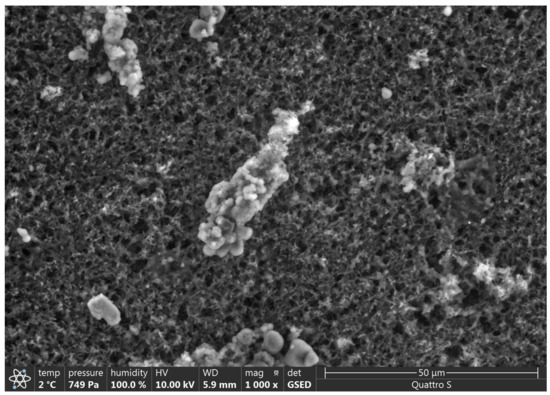 Determination of Hyaluronic Acid Dermal Filler Impurities Using SEM/EDS ...