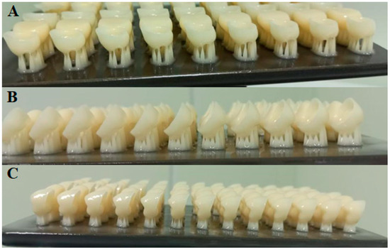 Fracture Load of 3D-Printed Interim Three-Unit Fixed Dental Prostheses ...
