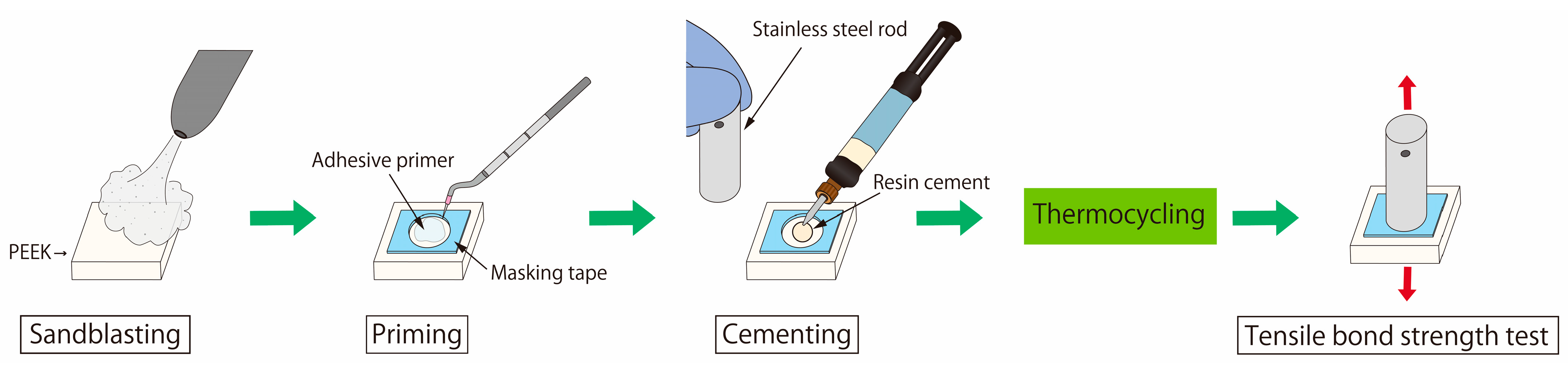 Bond Strength of Sandblasted PEEK with Dental Methyl Methacrylate-Based ...