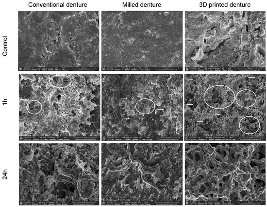 Influence of Fabrication Technique on Adhesion and Biofilm Formation of ...