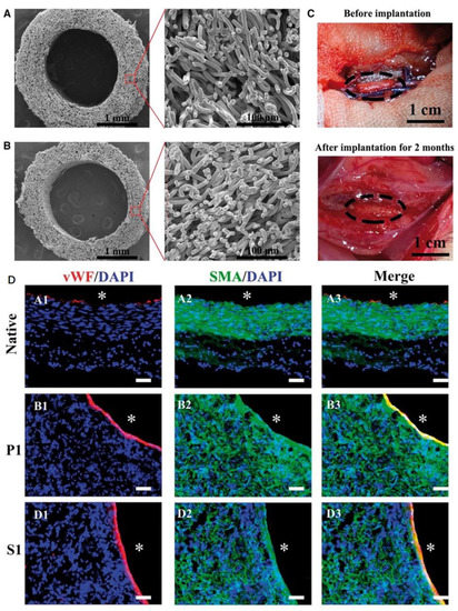 Current Strategies for Engineered Vascular Grafts and Vascularized ...