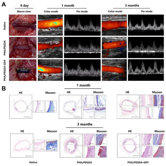 Current Strategies for Engineered Vascular Grafts and Vascularized ...