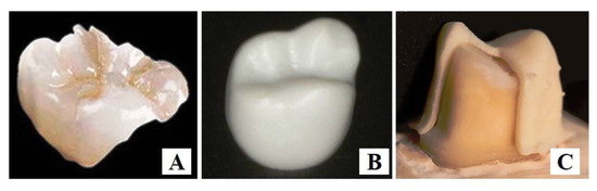 Dental Materials Applied to 3D and 4D Printing Technologies: A Review