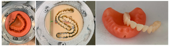 Adhesion of Conventional, 3D-Printed and Milled Artificial Teeth to ...