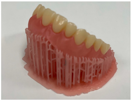 Adhesion of Conventional, 3D-Printed and Milled Artificial Teeth to ...