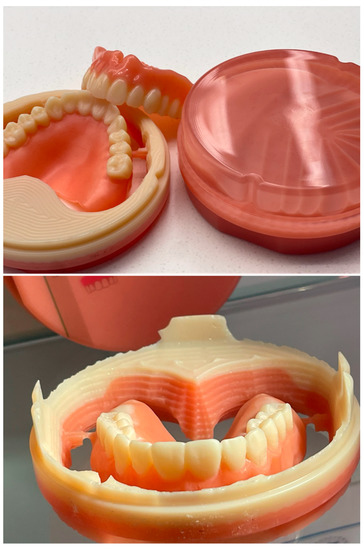Adhesion of Conventional, 3D-Printed and Milled Artificial Teeth to ...