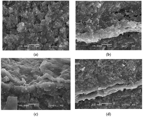 Development of Light-Polymerized Dental Composite Resin Reinforced with ...