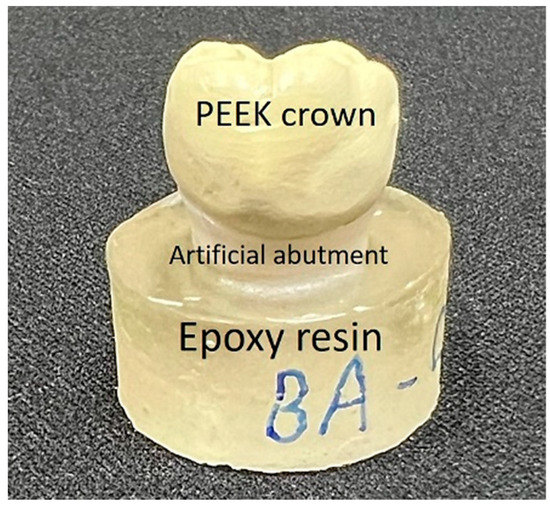 Fracture Characteristics of Commercial PEEK Dental Crowns: Combining ...