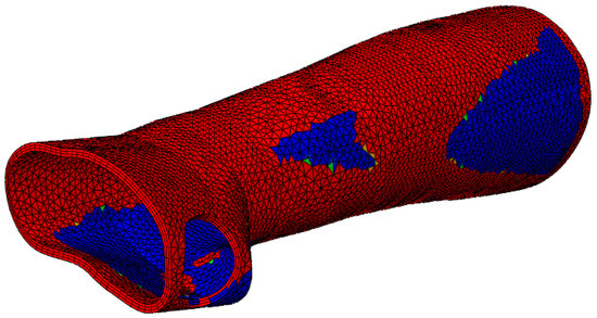 Polymers | Free Full-Text | Finite Element Analysis of Upper Limb ...