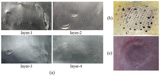 Clinical Development and Evaluation of a Multi-Component Dissolving ...