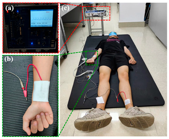 Washable and Flexible Screen-Printed Ag/AgCl Electrode on Textiles for ...