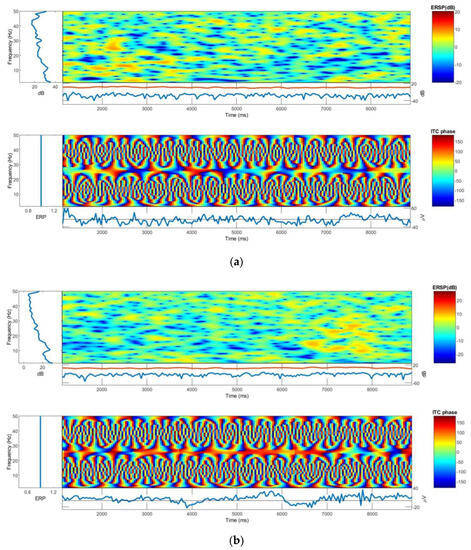 Hook Fabric Electroencephalography Electrode for Brain Activity ...