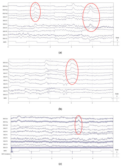 Hook Fabric Electroencephalography Electrode for Brain Activity ...