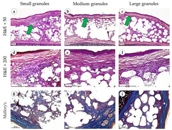 Surface Topography of PLA Implants Defines the Outcome of Foreign Body ...