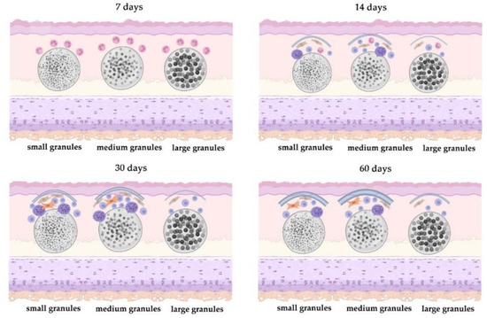 Surface Topography of PLA Implants Defines the Outcome of Foreign Body Reaction: An In Vivo Study