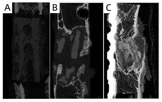 Mineralized Collagen/Polylactic Acid Composite Scaffolds for Load ...