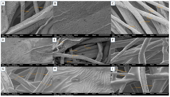 Poly (ε-caprolactone)-Based Scaffolds with Multizonal Architecture: Synthesis, Characterization ...