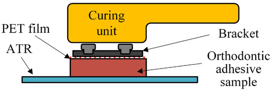Polymers | Free Full-Text | Influence of the Bracket Material on the ...
