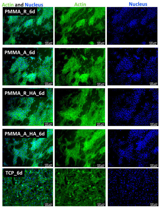 Development of Poly(methyl methacrylate)/nano-hydroxyapatite (PMMA/nHA) Nanofibers for Tissue ...